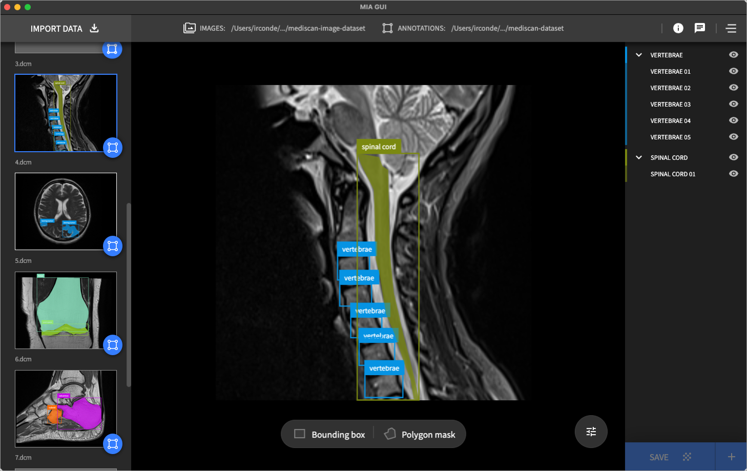 Medical Imaging Annotation - Emerging Analytics Center